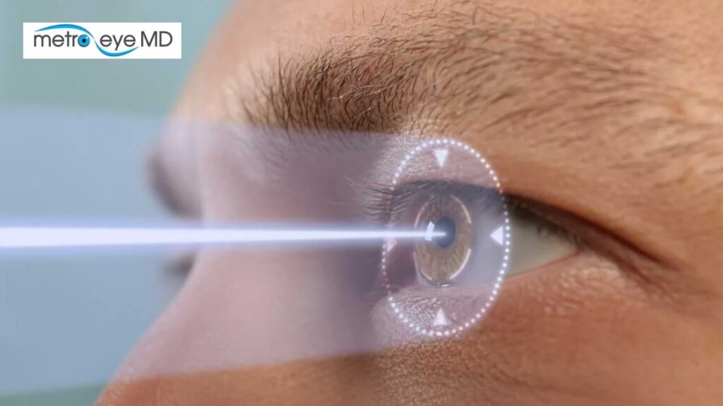 Lasik Eye Surgery in New York, NY | Metro Eye MD